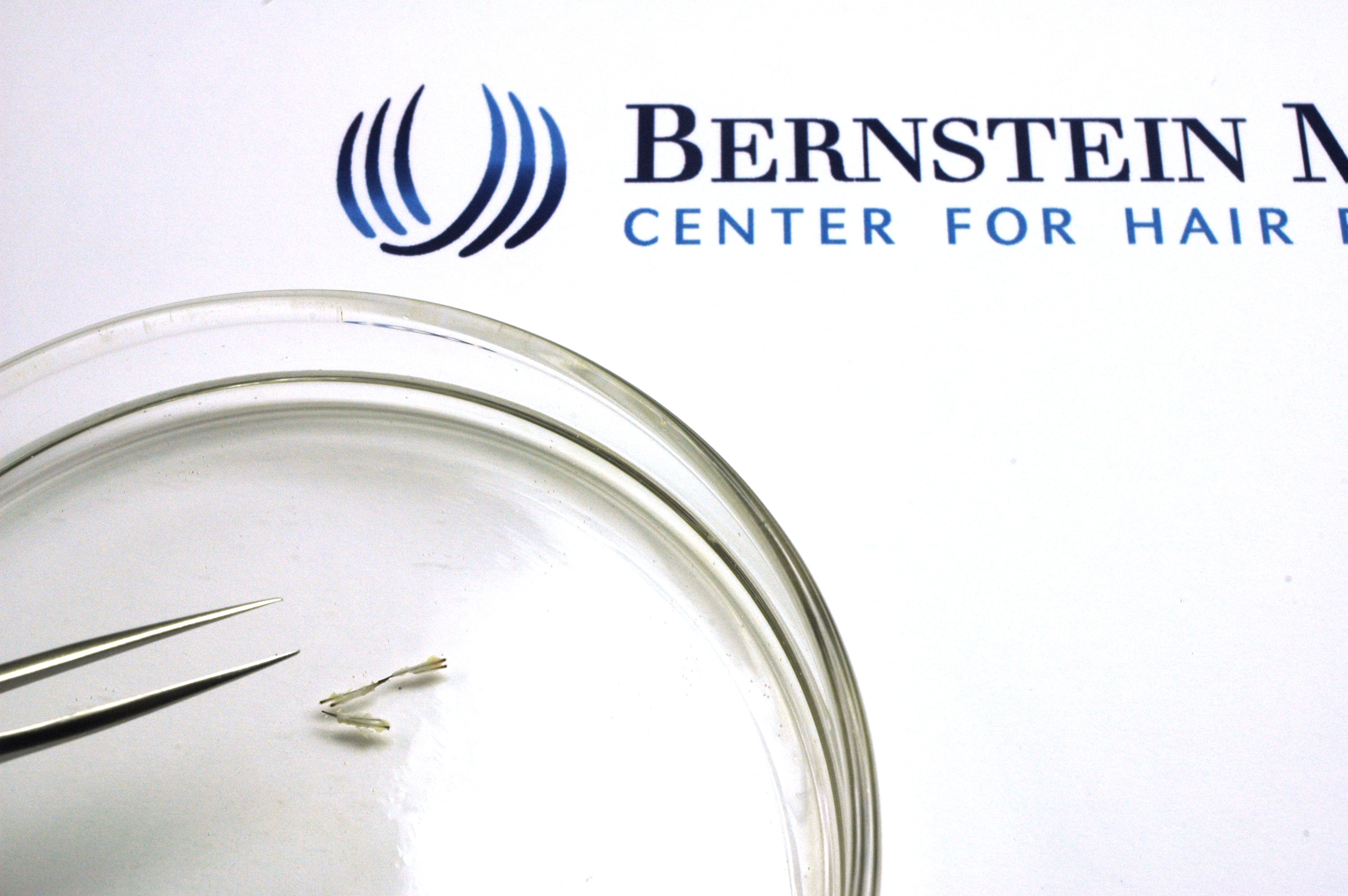 Hair Transplant Research And Publications Bernstein Medical