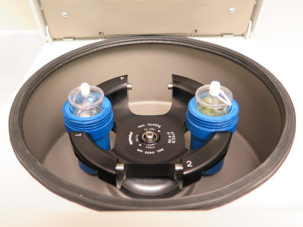 PRP Double Centrifuge Technique - Bernstein Medical - Center for Hair ...